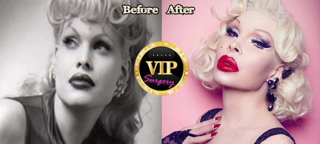 Amanda Lepore Plastic Surgery Before and After Photos